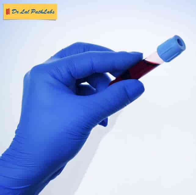 Dr Lal PathLabs in Hoshangabad Road,Bhopal - Best Pathology Labs in ...