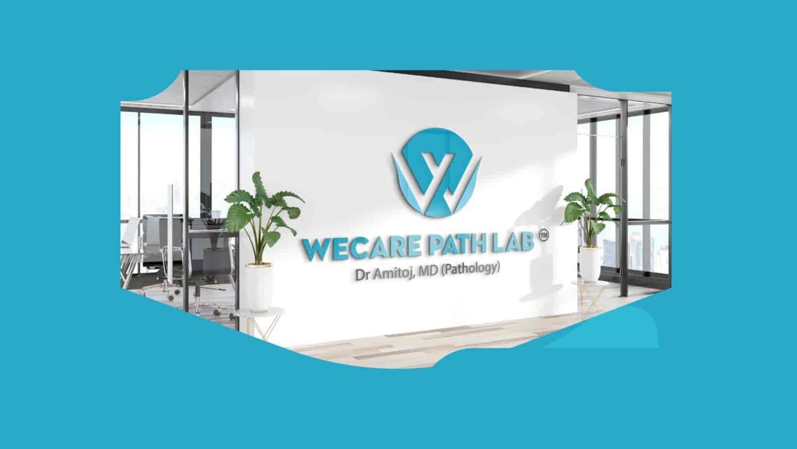 Top Diagnostic Centres For D Dimer in Chandigarh Sector 17b, Chandigarh near me - Justdial