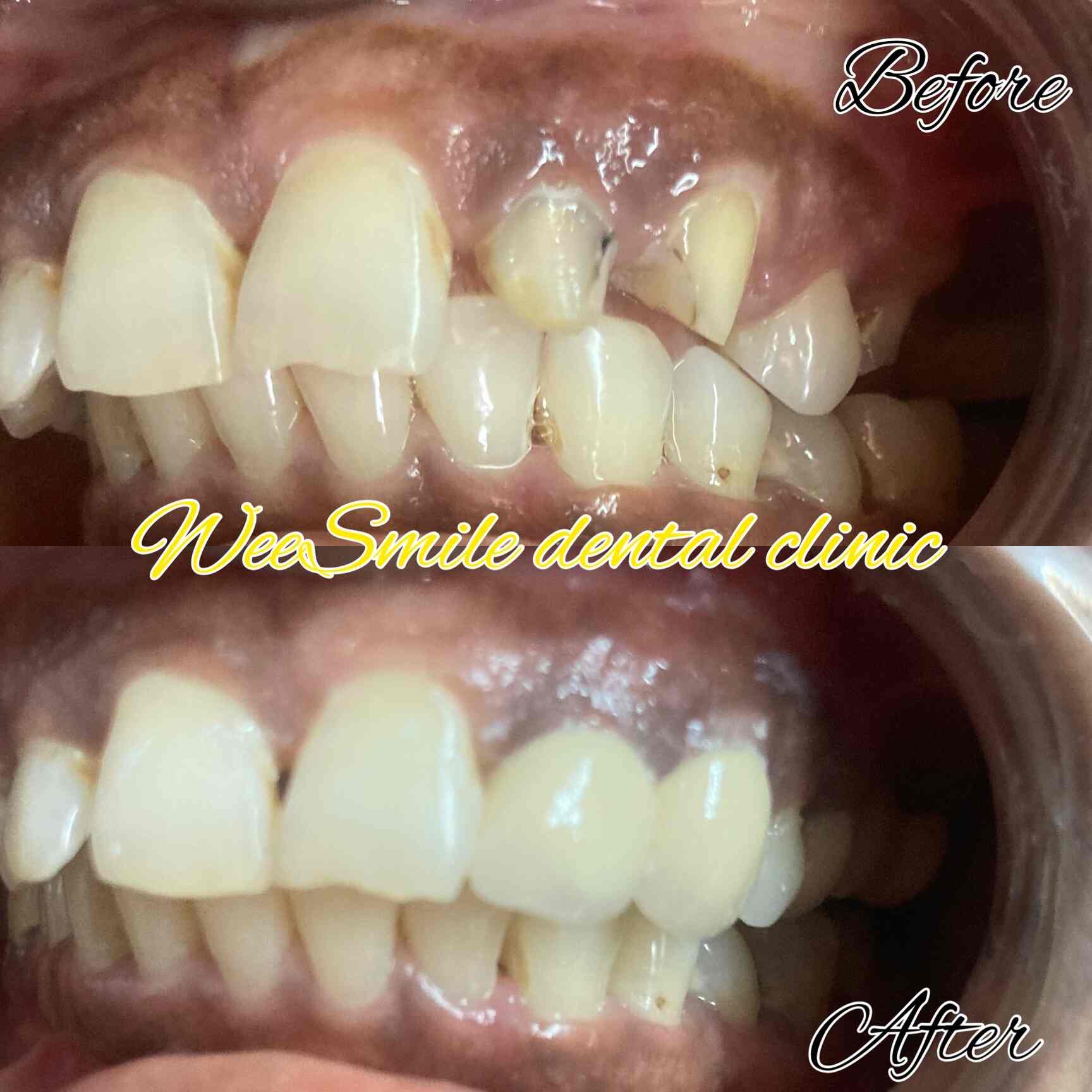 Weesmile Dental Clinic in Tharamani,Chennai - Best Dental Clinics in ...