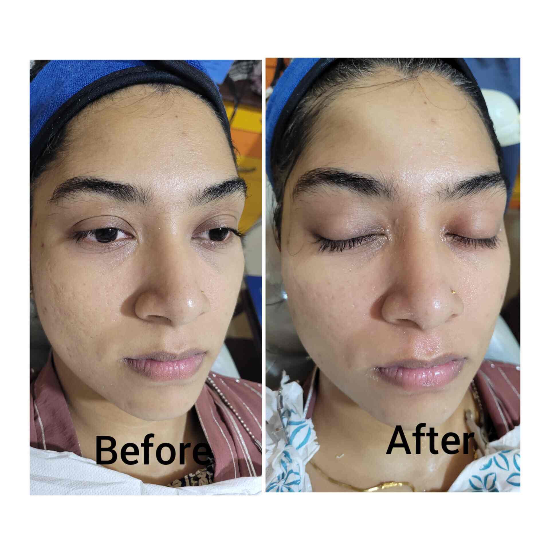 Renaissance Skin & Hair Laser Clinic in Thiruvanmiyur,Chennai - Book ...