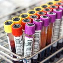 Nucleozol One Phase Rna Purification in Perundurai - Dealers ...