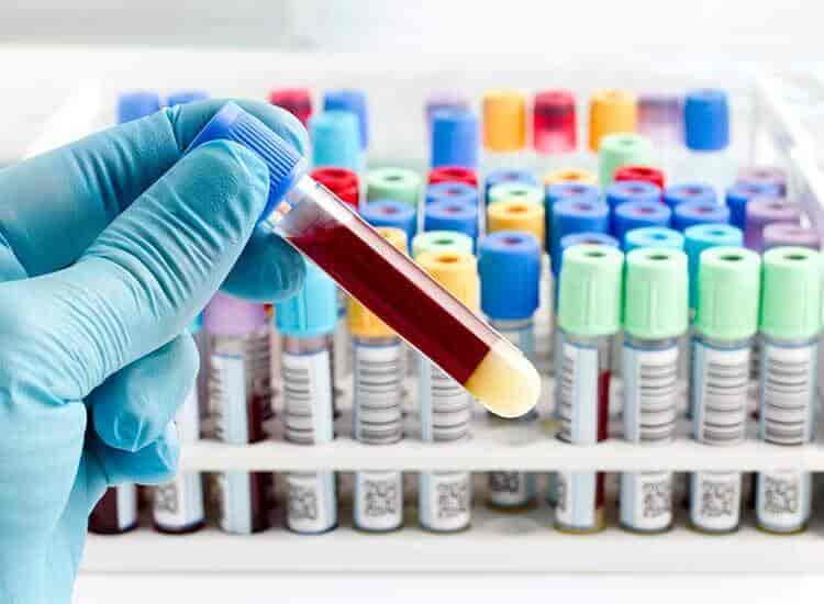 MEDANTA LABs in Doctors Colony,Bihar Sharif - Best Pathology Labs near ...