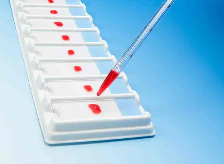 Sai Ganesh Pathology & Laboratory Centre in Dombivli East,Mumbai - Best ...