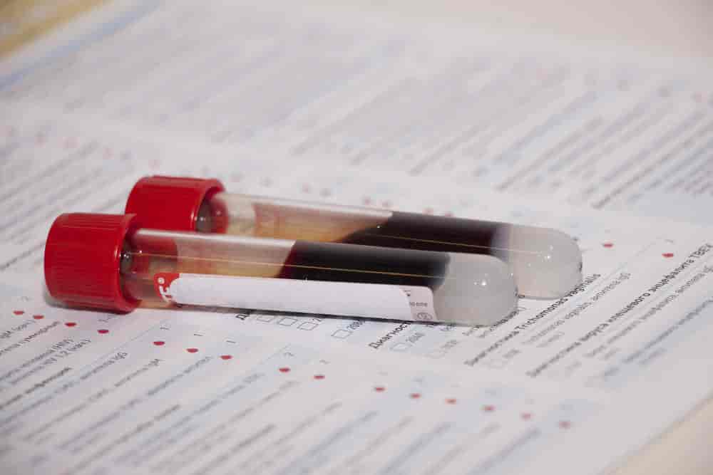 Max lab in Max Lab,Delhi - Best Pathology Labs in Delhi - Justdial