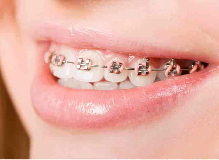 Smile Care Dental Clinic in Santacruz East,Mumbai - Best Dental Clinics ...