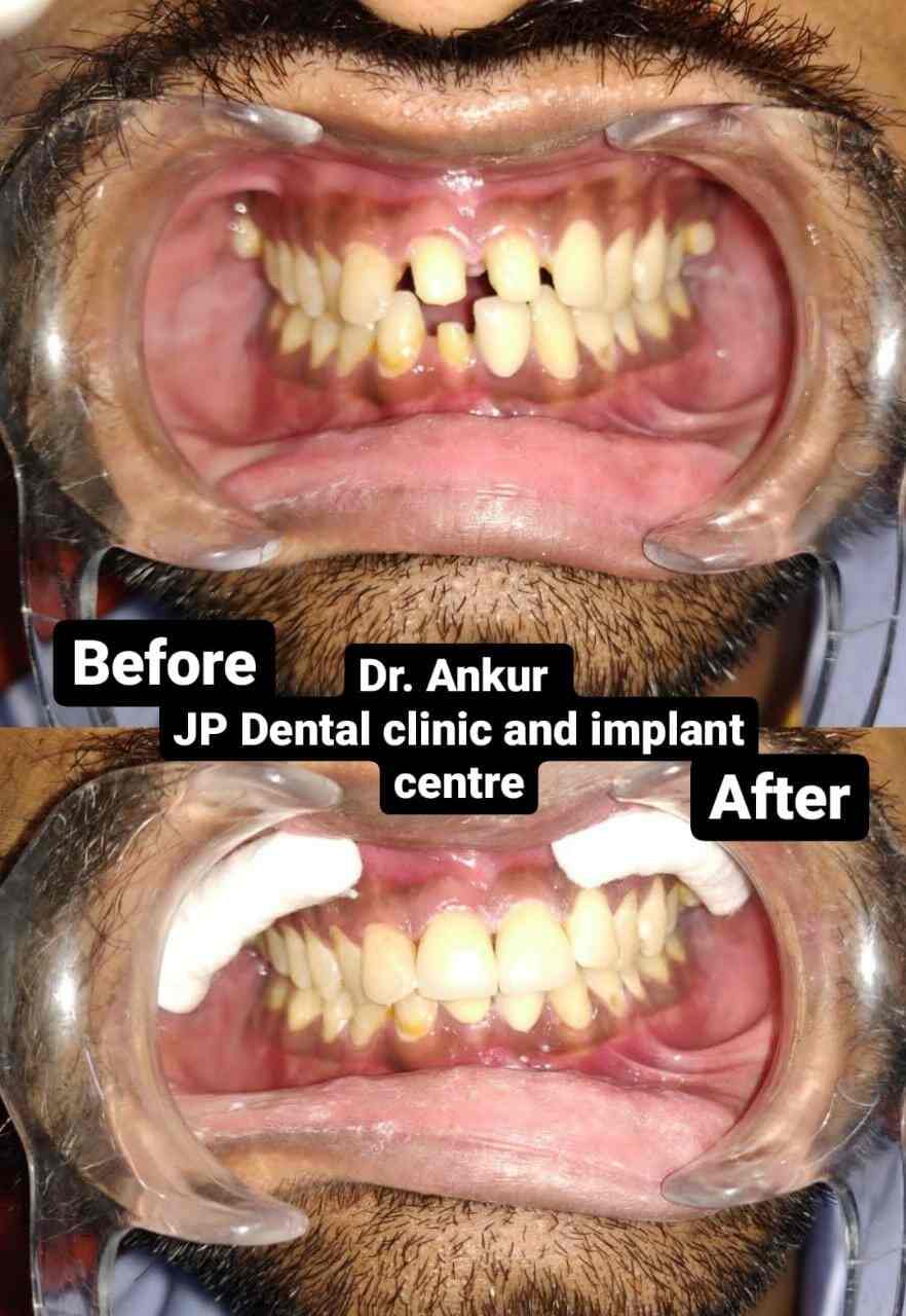 Jp Dental Clinic and Implant Centre in Ballupur,Dehradun - Best Dental ...