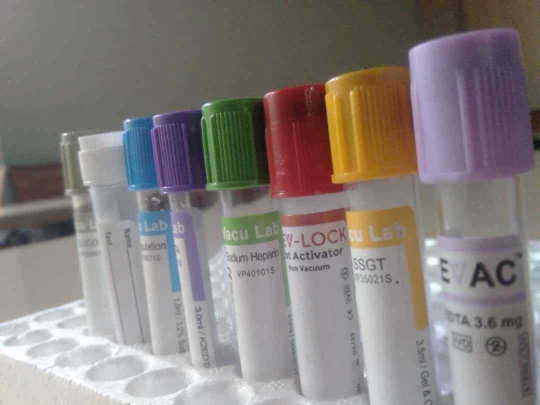 Accuprobe Healthcare & Diagnostics in Noida Sector 22,Delhi - Best ...