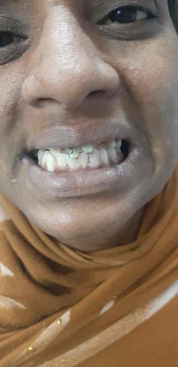 Teeth & Jaws Dental Hospital in Kotha Peta,Guntur - Book Appointment ...