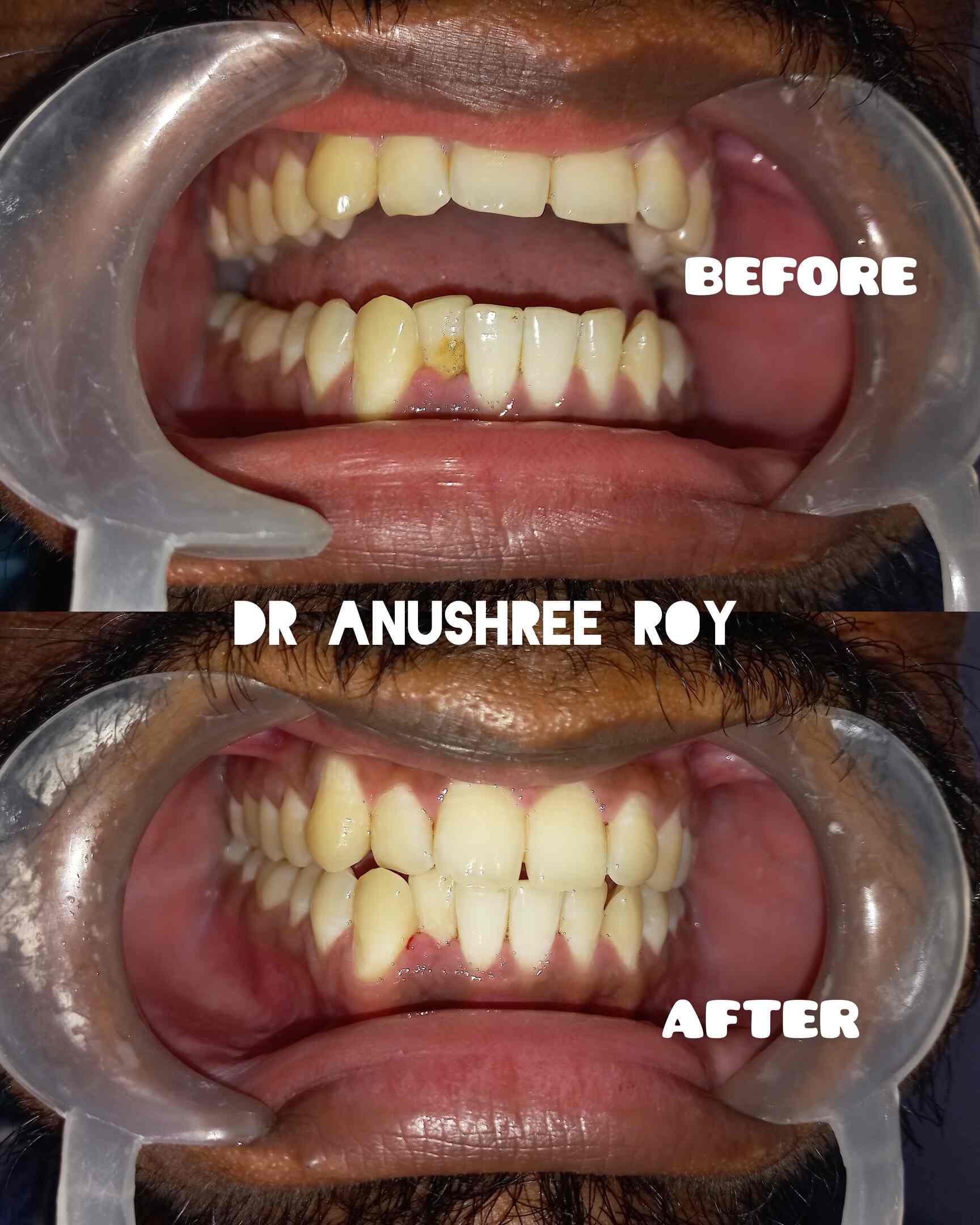 Dr Anushree Roy in Arambagh,Hooghly - Best Dentists in Hooghly - Justdial