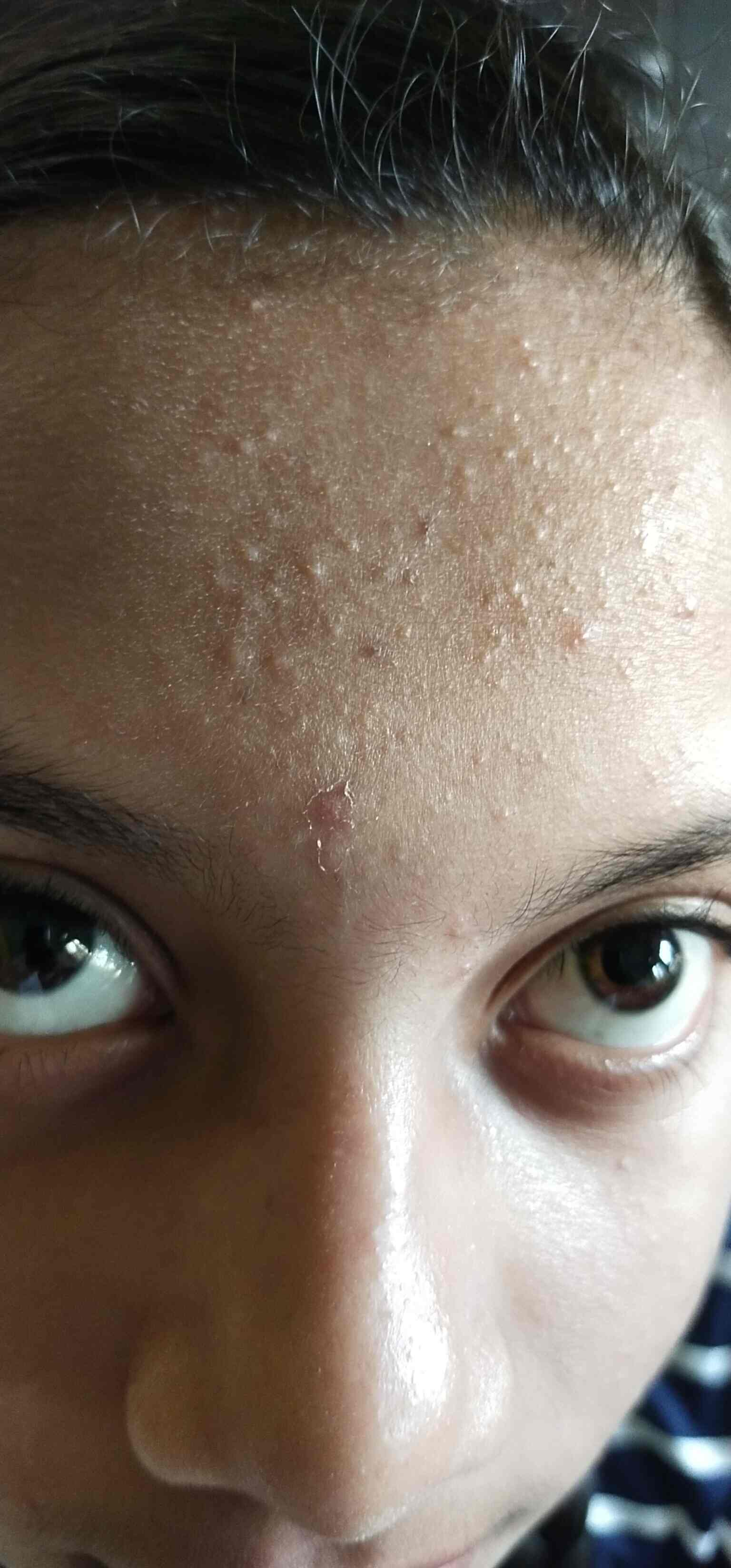 Goutham Reddy Dermatologist Clinic in Tarnaka,Hyderabad - Best ...