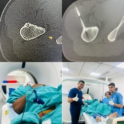 Dr. Ankit Singhvi in Adarsh Nagar,Jaipur - Best Angiography Testing ...