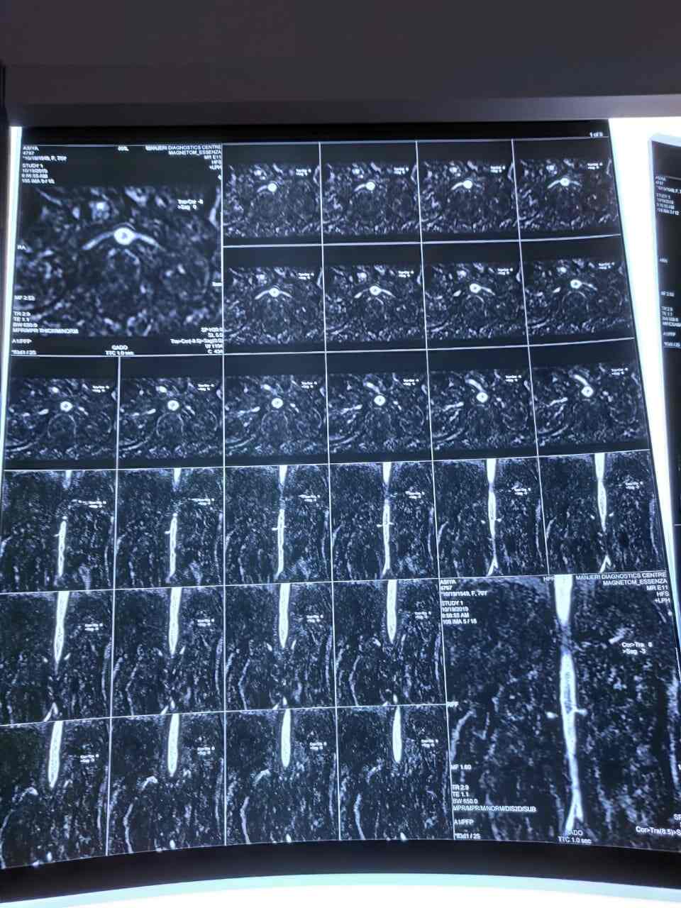 Mdc Atm in Manjeri Kla,Malappuram - Best ATM in Malappuram - Justdial