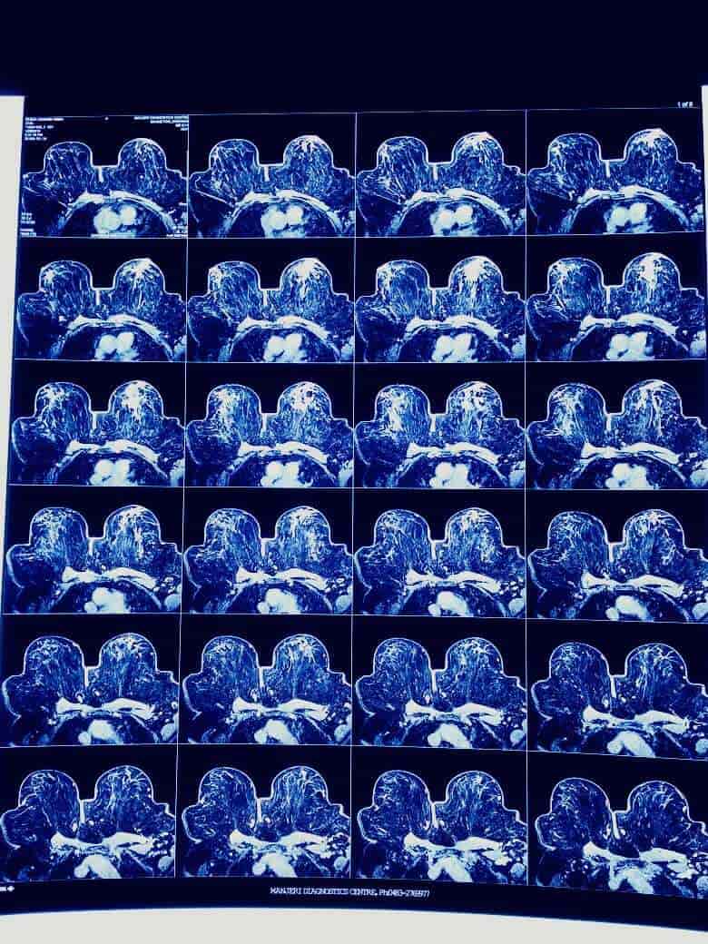 Mdc Atm in Manjeri Kla,Malappuram - Best ATM in Malappuram - Justdial