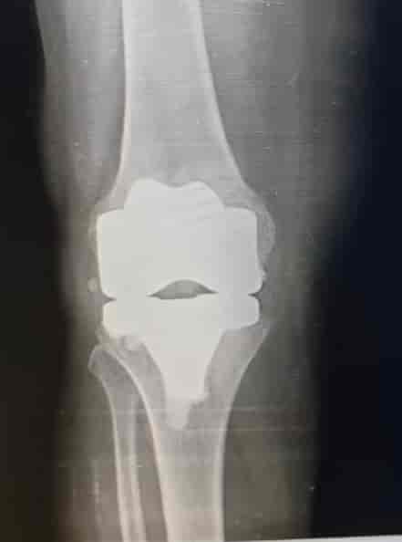 Dr.Amarnath Savur Orthopaedic Clinic in Falnir,Mangalore - Best ...
