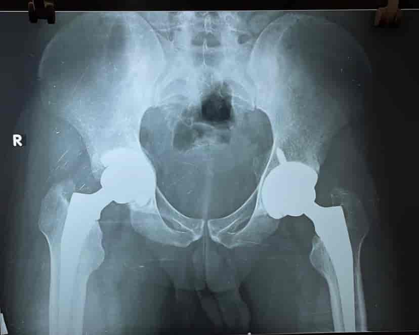 Dr.Amarnath Savur Orthopaedic Clinic in Falnir,Mangalore - Best ...