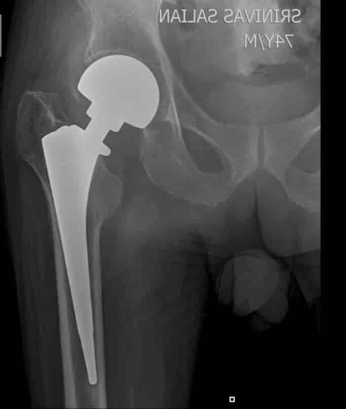 Dr.Amarnath Savur Orthopaedic Clinic in Falnir,Mangalore - Best ...