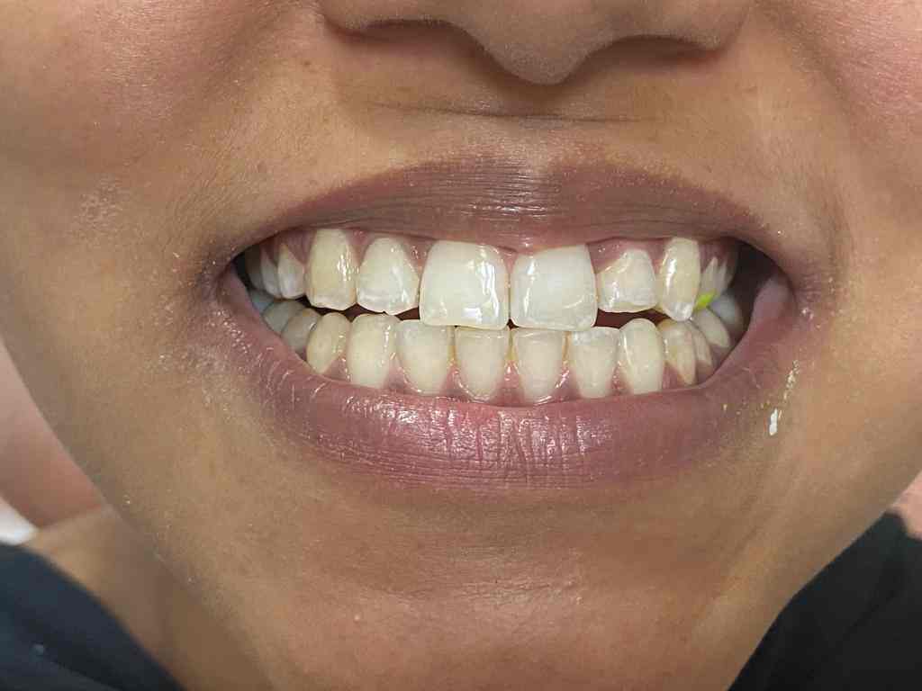 Dr Kaushik's Cbct Opg Microscope Dental And Implant Clinic in ...