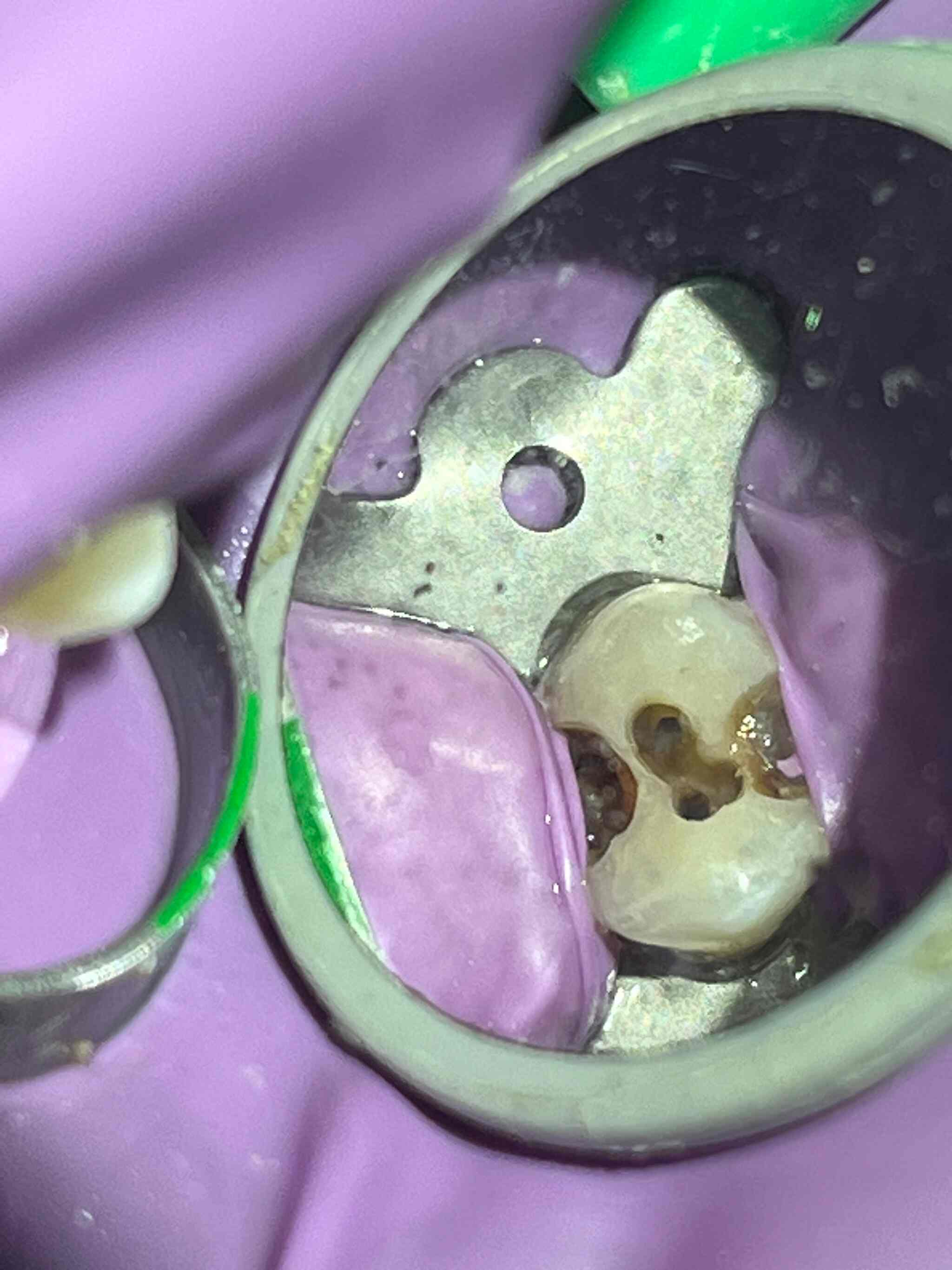 Dr Kaushik's Cbct Opg Microscope Dental And Implant Clinic in ...