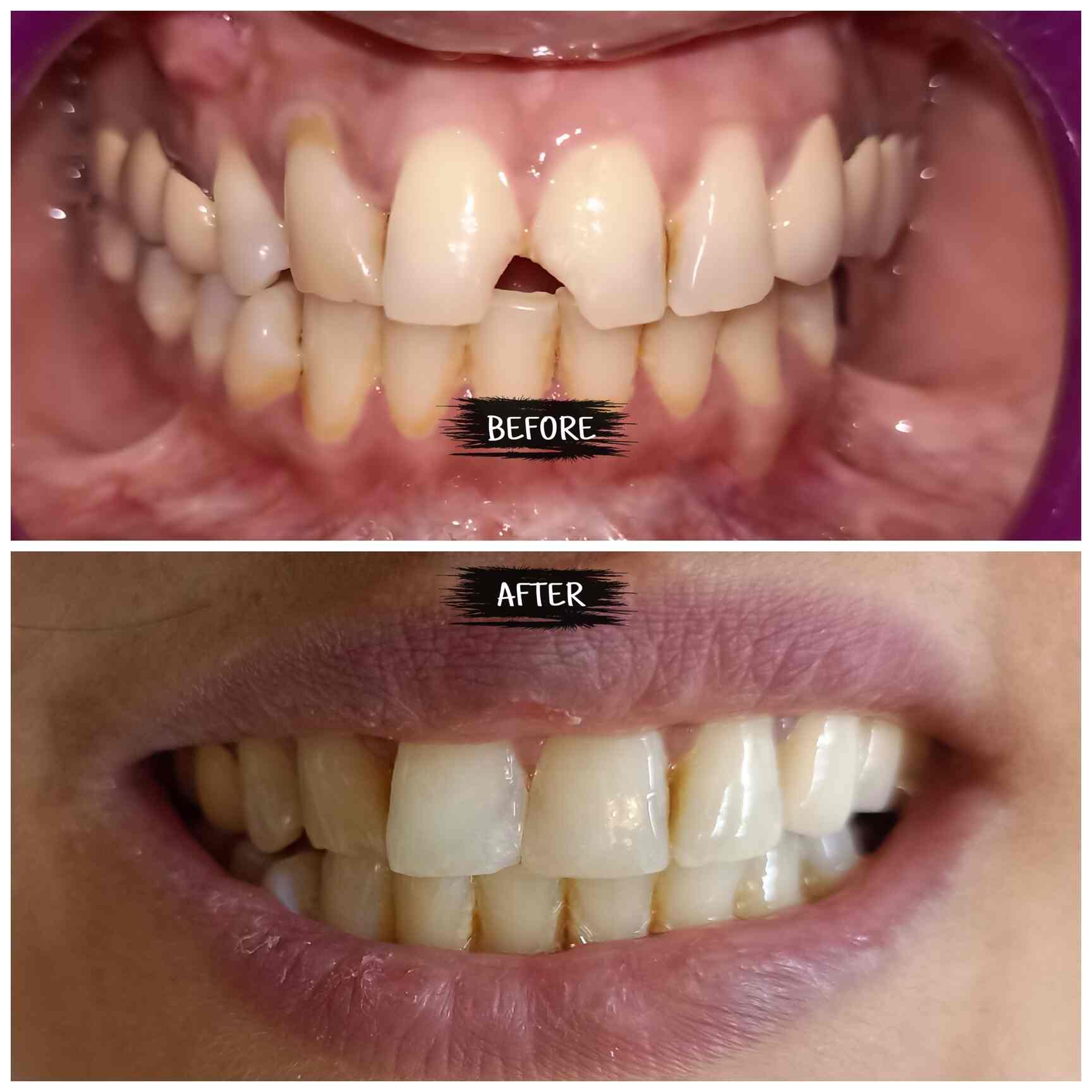 Dr. Mariya Tambawala in Mcgm Colony,Mumbai - Best Dentists in Mumbai ...