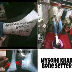 Mysore Khan Bone Setter (Closed Down) in Kyathamaranahalli,Mysore ...