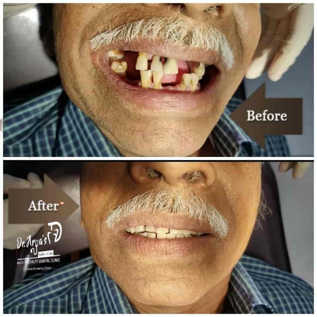 Dr Aryas Smile And Care Dental Clinic In Kurampala Southpathanamthitta Best Dental Clinics In
