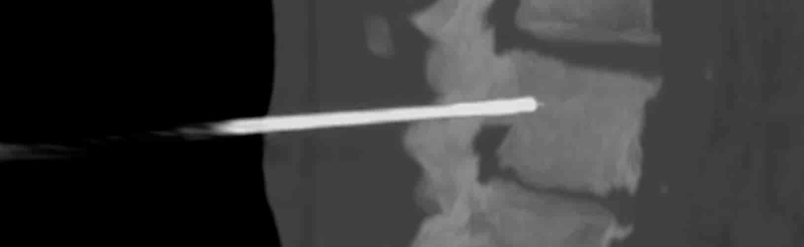 Top Diagnostic Centres For 2d And 3d Sonography in Raipur-Chhattisgarh ...