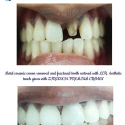 Chendure Dental Care in Samalapuram,Tirupur - Best Dental Clinics near ...