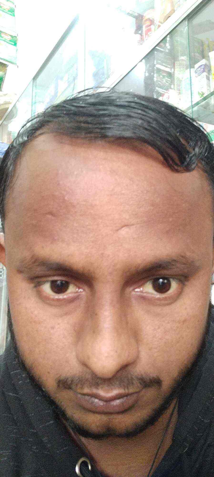 Dr. Vaibhav Upadhyay (Dr. Upadhyay Hair And Skin Care) in D 58/12-2 ...