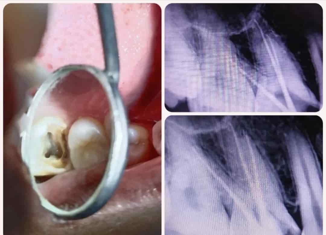 Preetha Dental Care in Sathuvachari,Vellore - Best Dental Clinics near ...