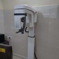 Top 3d Transesophageal Echocardiogram Testing Centres in Chennai near ...