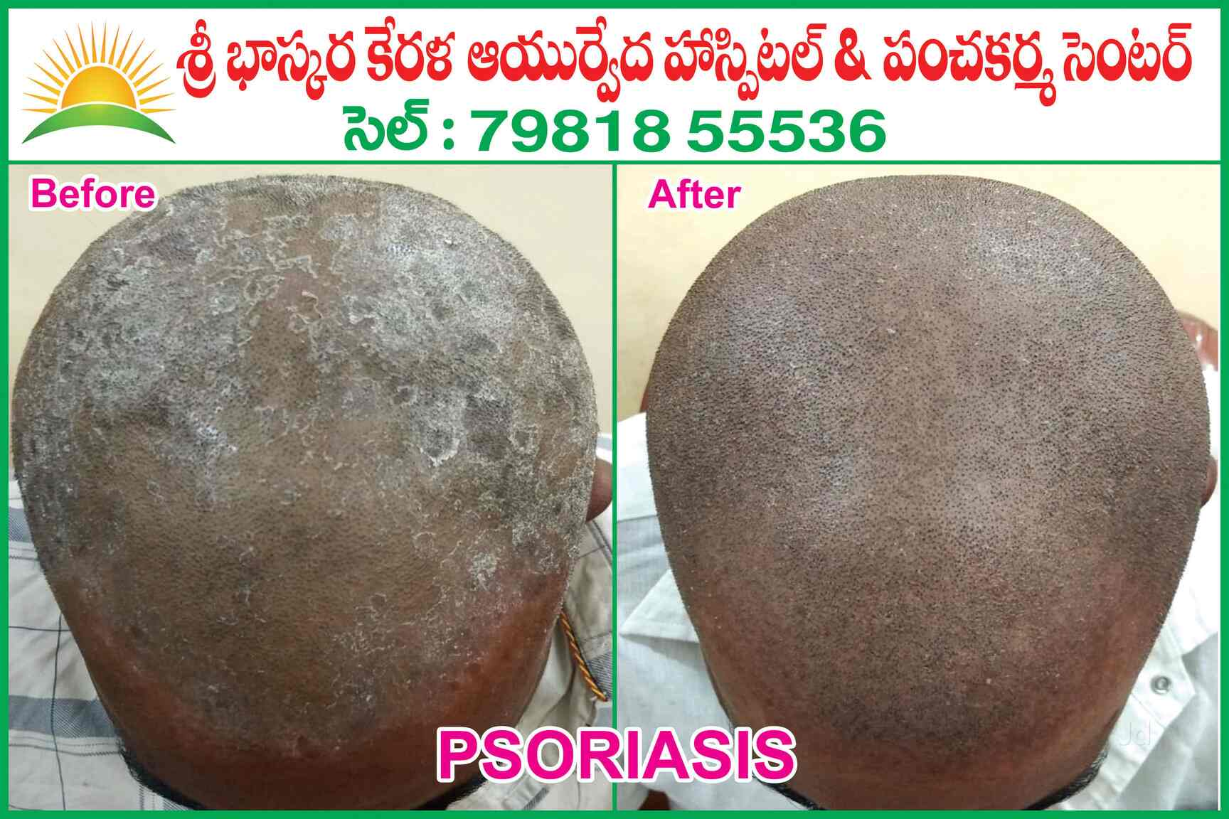 Top Public Ayurvedic Hospitals in Kanuru - Best Government Ayurvedic ...