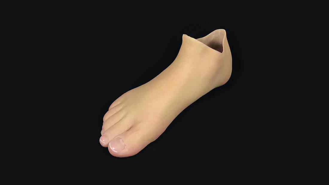 Silicone Foot Prosthesis in Patan Gujarat - Durable & Comfortable ...