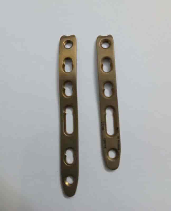 LCP Plate in Bangalore - Durable, High-Quality Orthopedic Plates ...