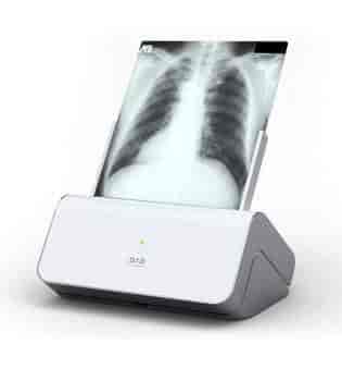 X Ray Film Digitizer in Hyderabad - High-Quality Imaging Solutions for ...