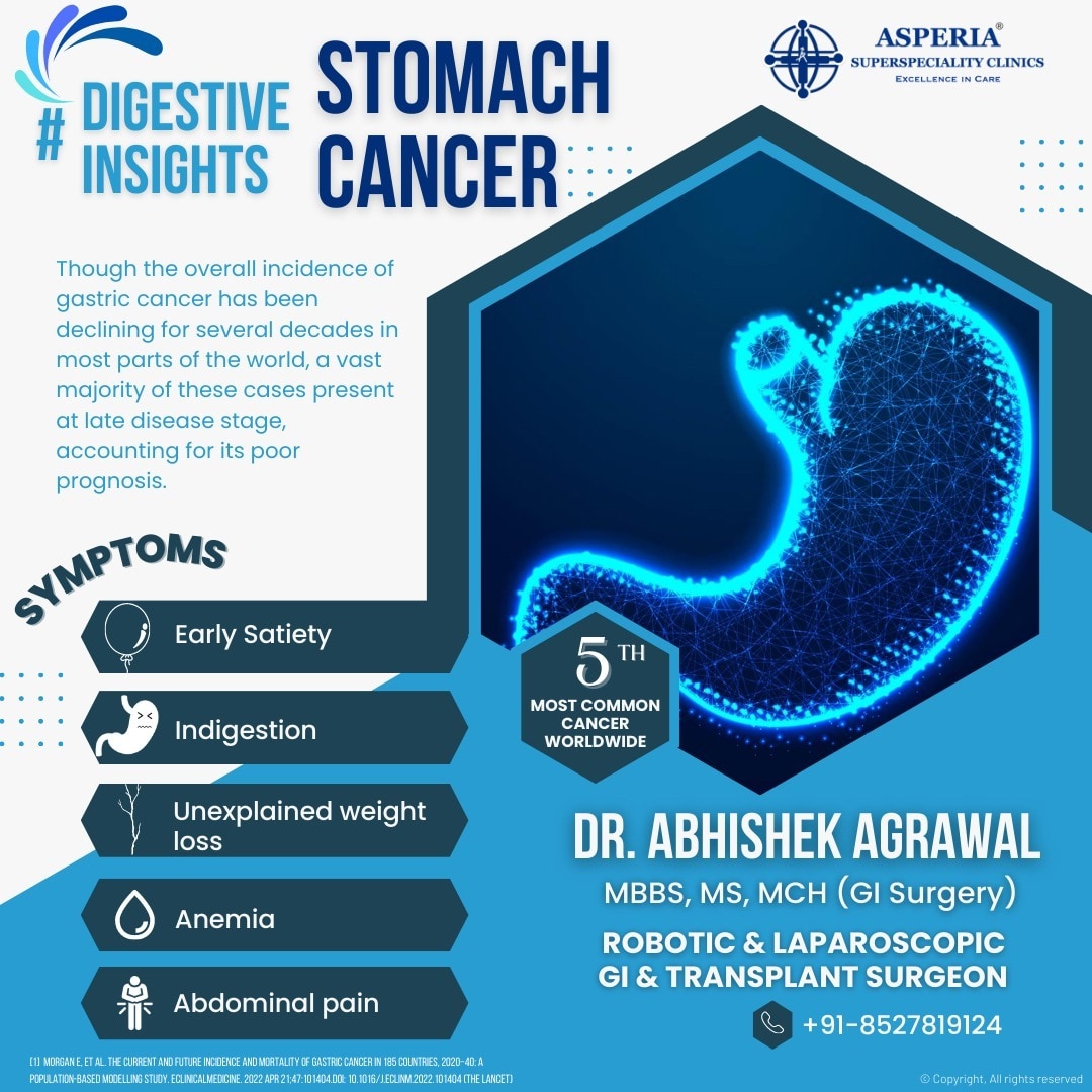 Dr. Abhishek Agrawal in Faridabad - Best Gastroenterologists near me in ...