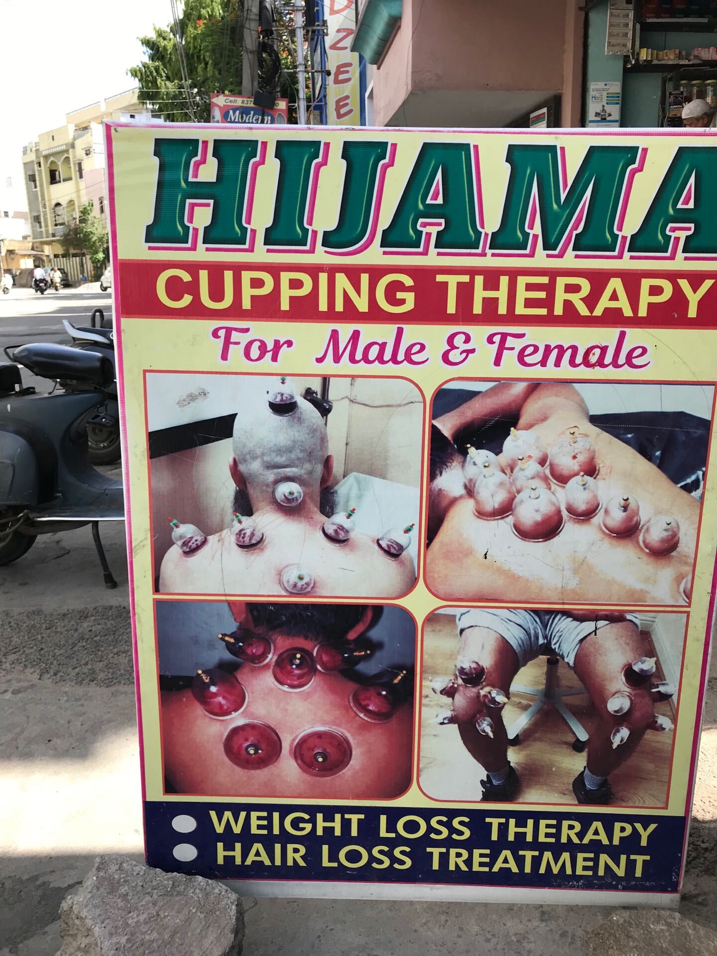 Orient Hijama Center in Chaderghat,Hyderabad - Best Cupping Therapy ...