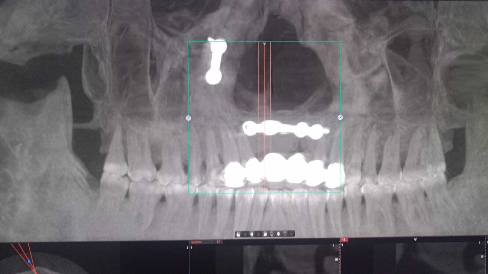 Mau Dental Cbct Center in Nizamuddinpura,Mau - Best X Ray Centres near ...